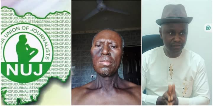 NUJ appeals to well-meaning Deltans to save journalist battling cancer